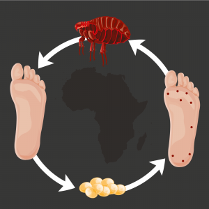 Sand Flea Bites on Humans - Pictures, Treatment and Prevention - FLEABITES